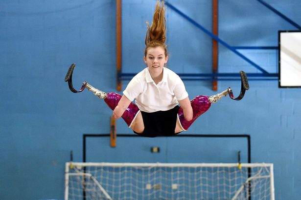 YouTube Sensation Isabelle Weall, a Quadruple Amputee Shows That ...